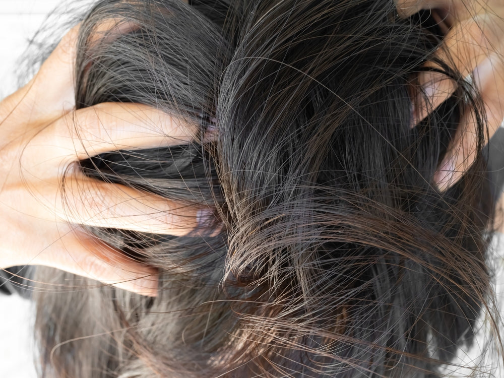 The Best Natural Dandruff Shampoo for Dry Scalp and Itchy Scalp – Zuma ...